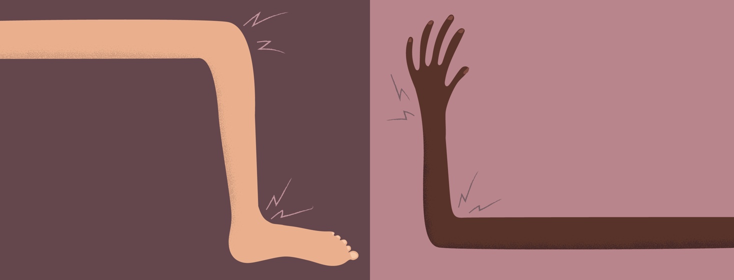 Psoriasis On The Elbows And Knees