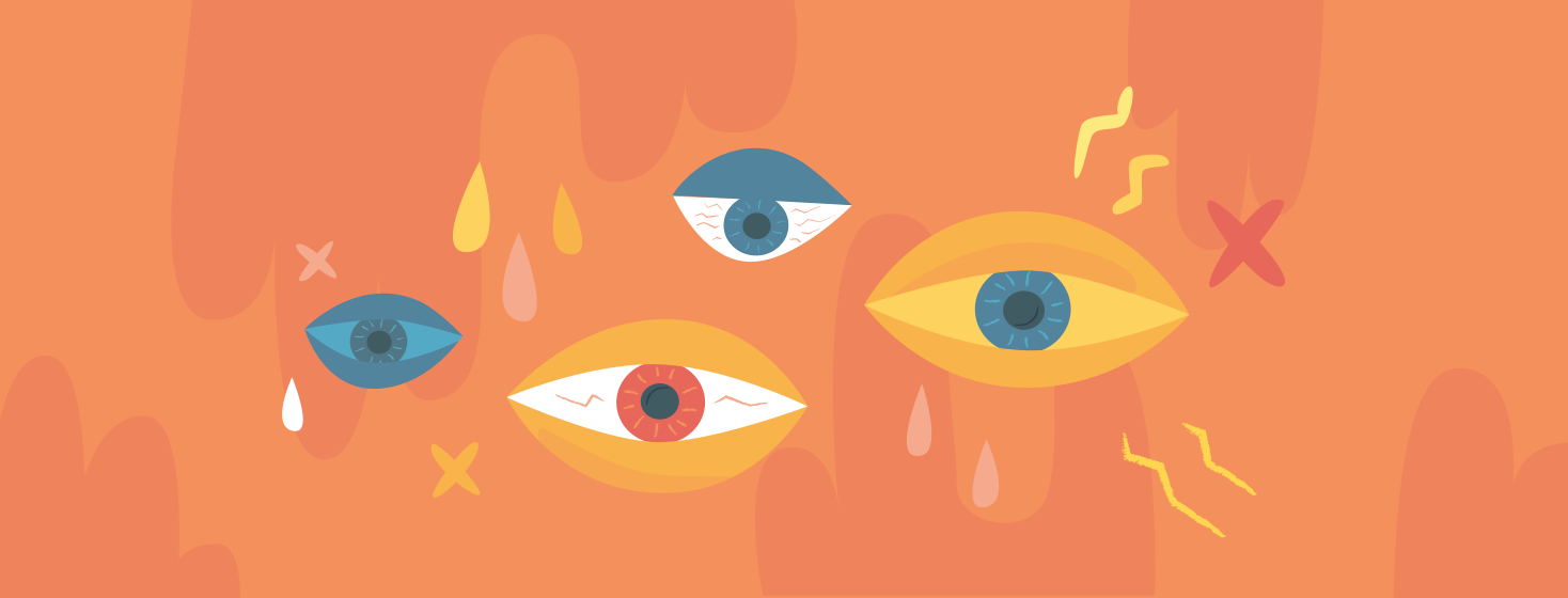 What Is The Connection Between Psoriasis and Uveitis?