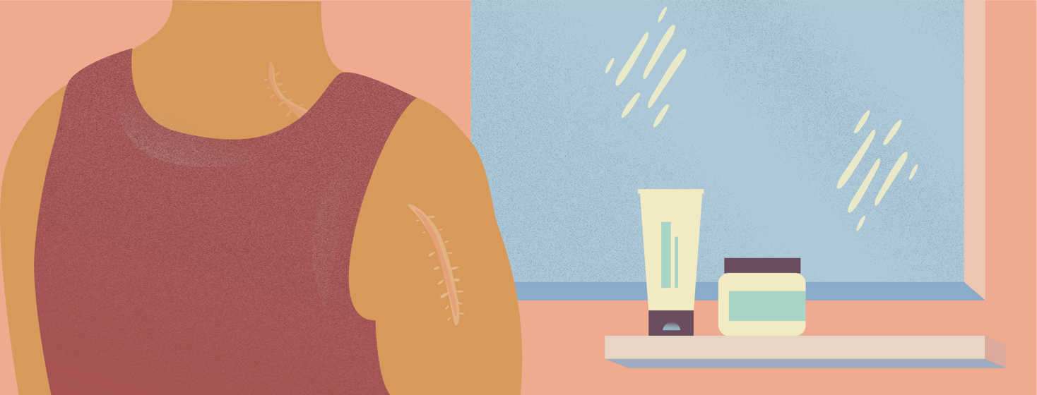 6 Frequently Asked Questions about Koebner Phenomenon - PlaquePsoriasis.com