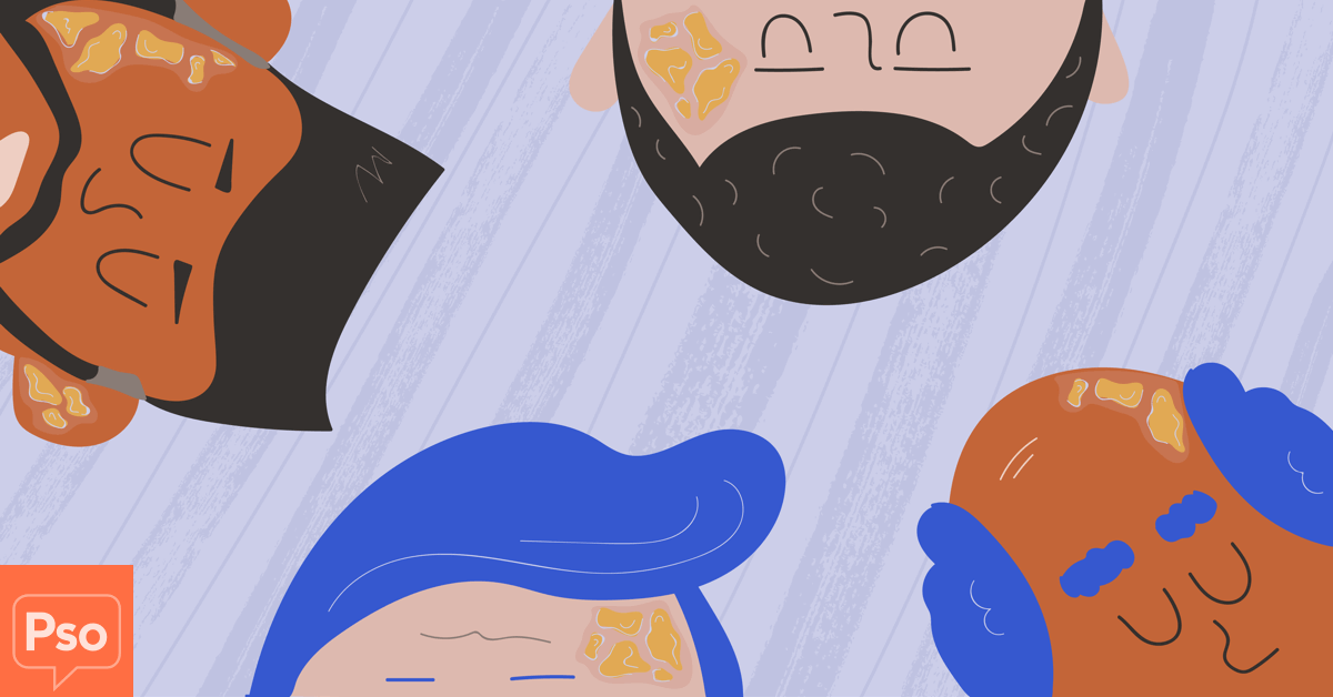 Symptoms & Treatment Options for Diagnosing Sebopsoriasis