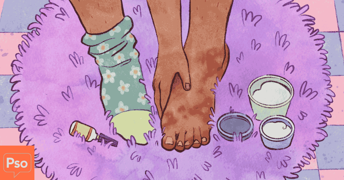 Tips for Managing Psoriasis on the Feet