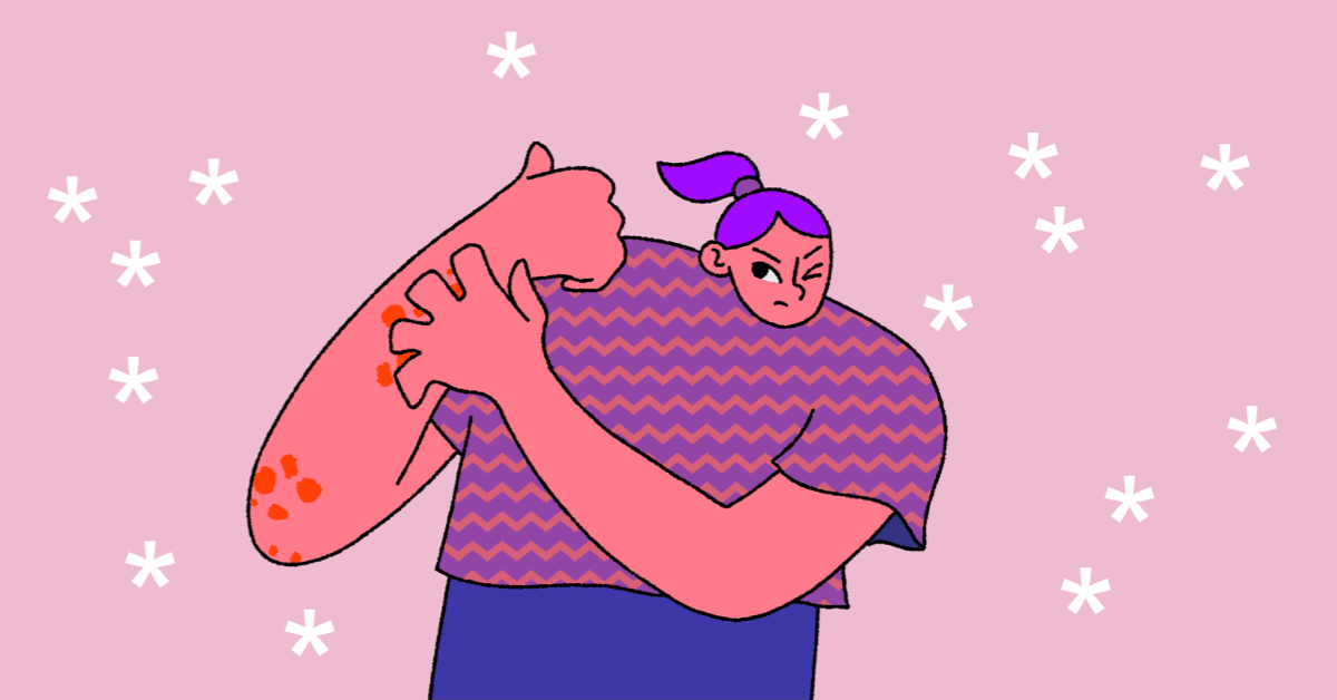 Resist Scratching Your Psoriasis Patches | PlaquePsoriasis.com