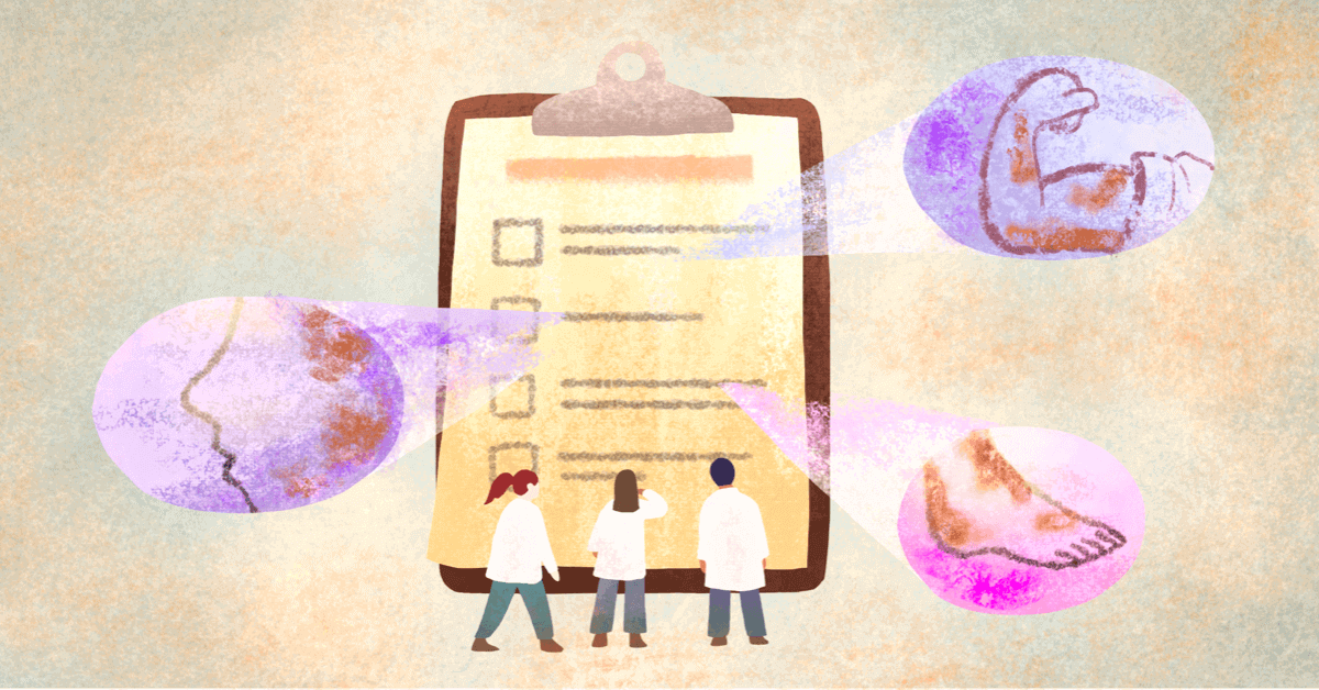 Pustular Psoriasis Treatment Options | PlaquePsoriasis.com